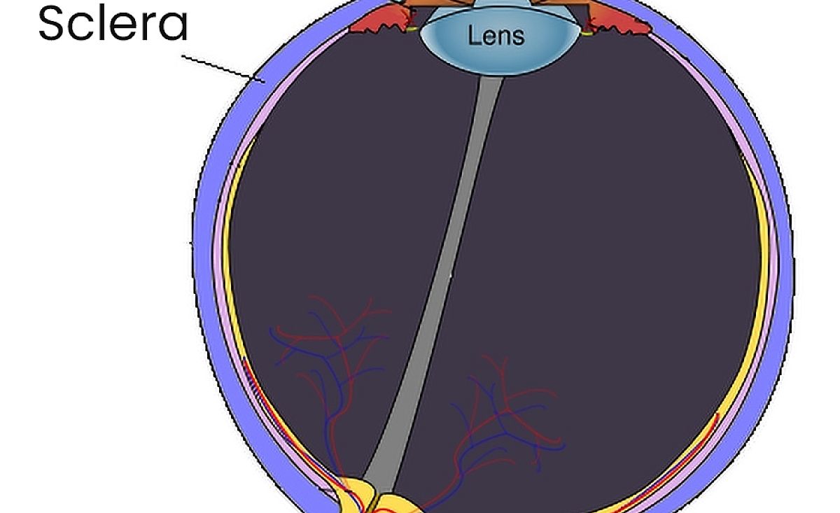Corneal Transplants: When They’re Needed | Cure Blindness Project