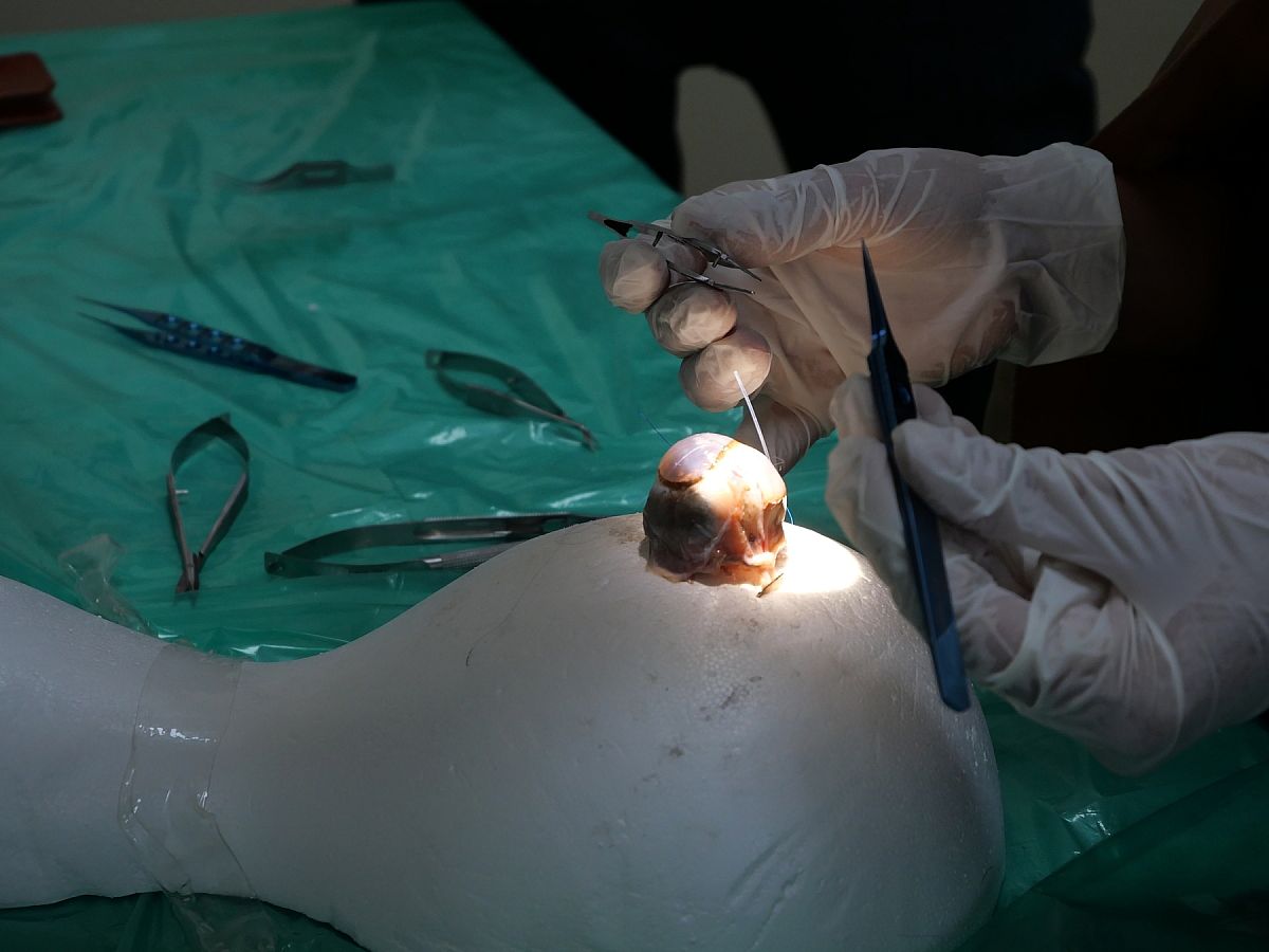 Glaucoma: Symptoms, Causes and Treatments | Cure Blindness Project