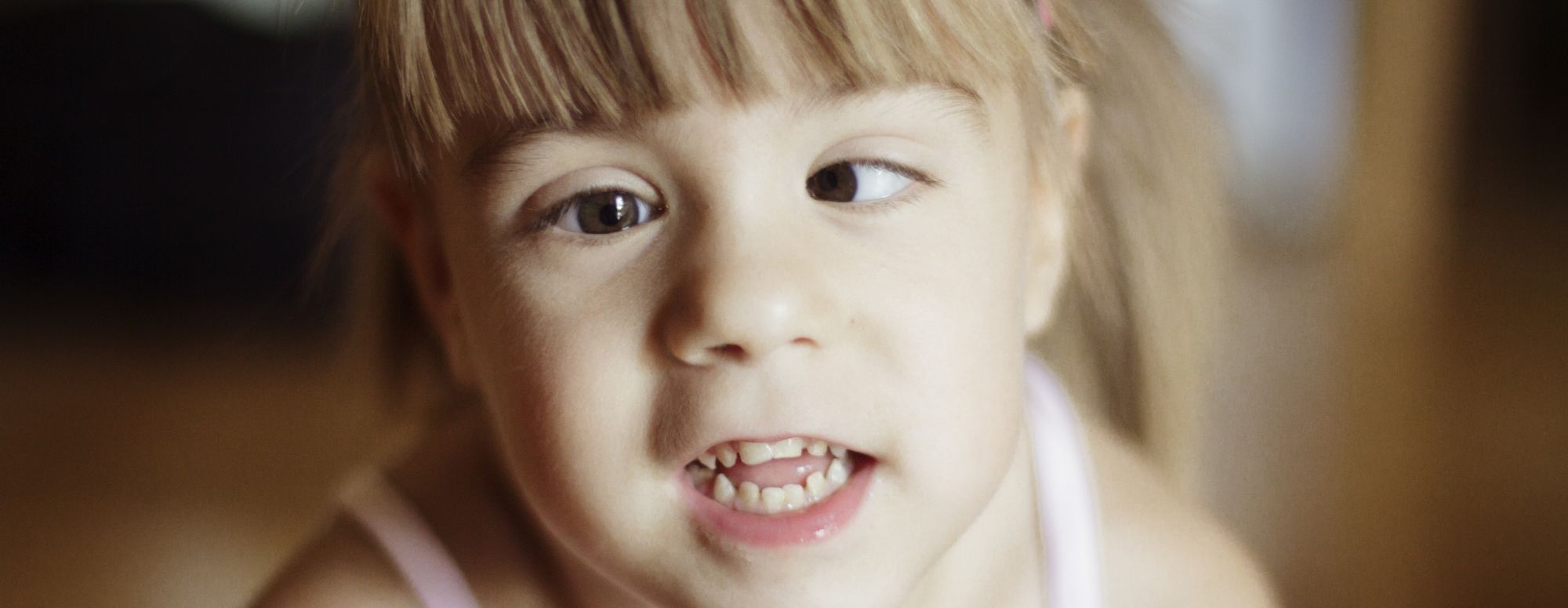 Strabismus: Symptoms, Causes and Treatments | Cure Blindness Project