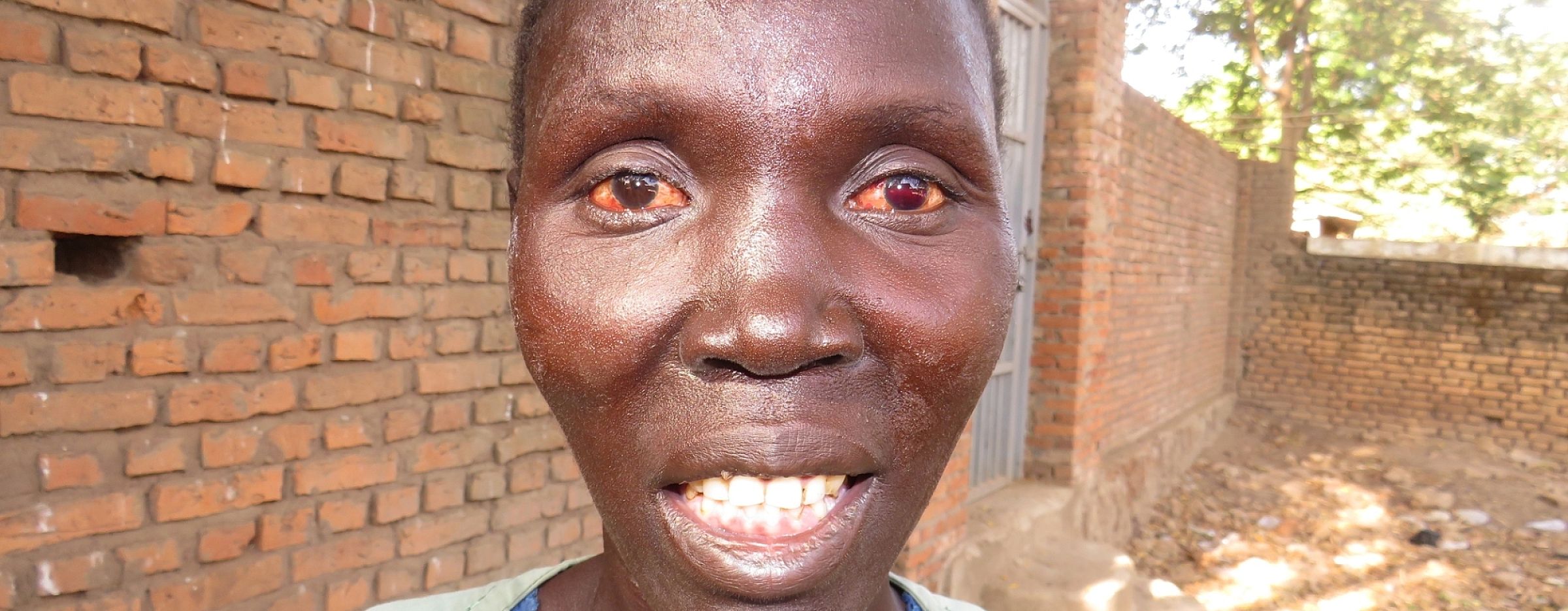 A Blind Mother Raising Her Kids Alone