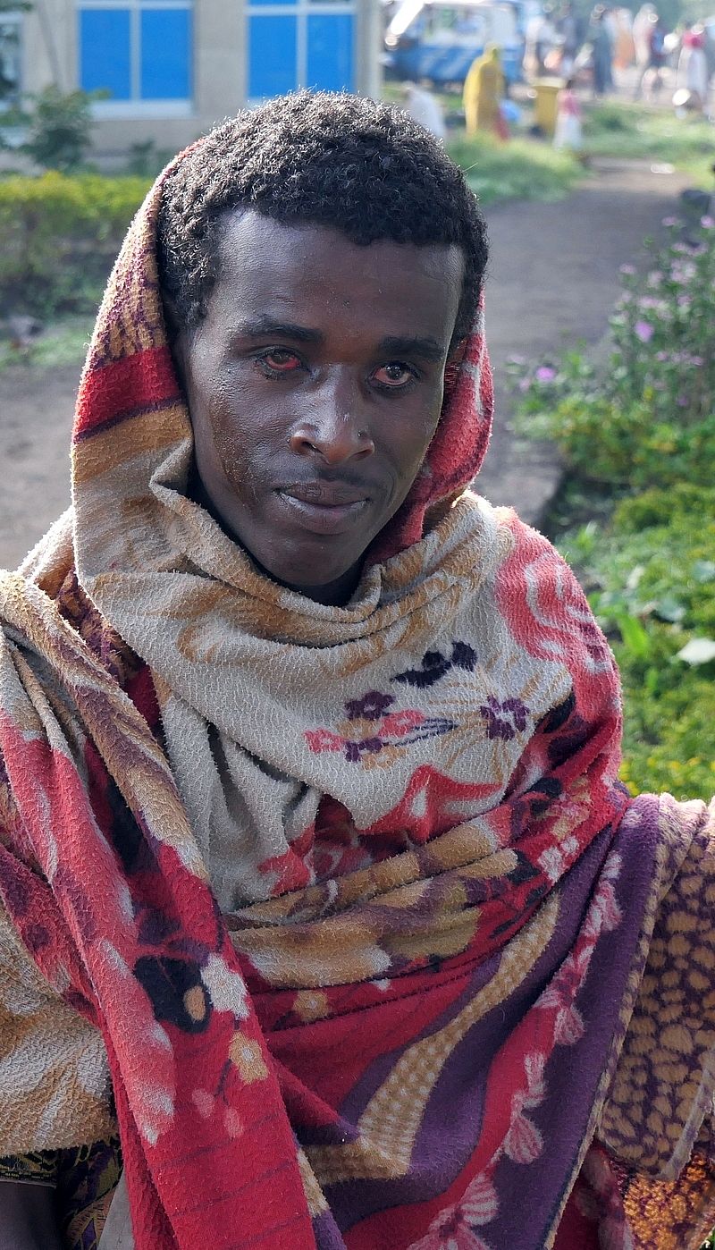 Patient Story: Medeset Misgana