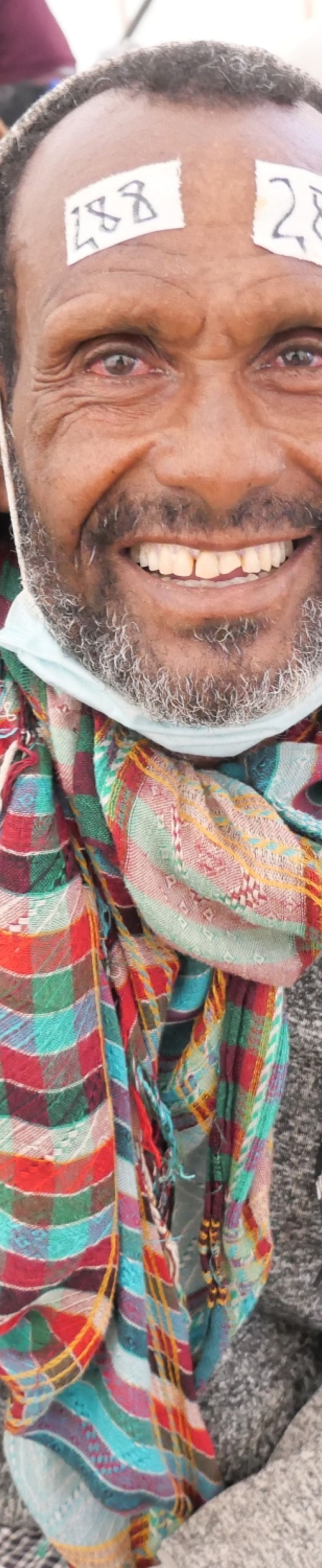 Vision is Power: Restoring Vision for Over… | Cure Blindness Project